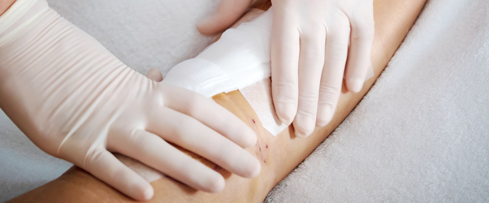 The Power of Proper Wound Dressing for Optimal Healing
