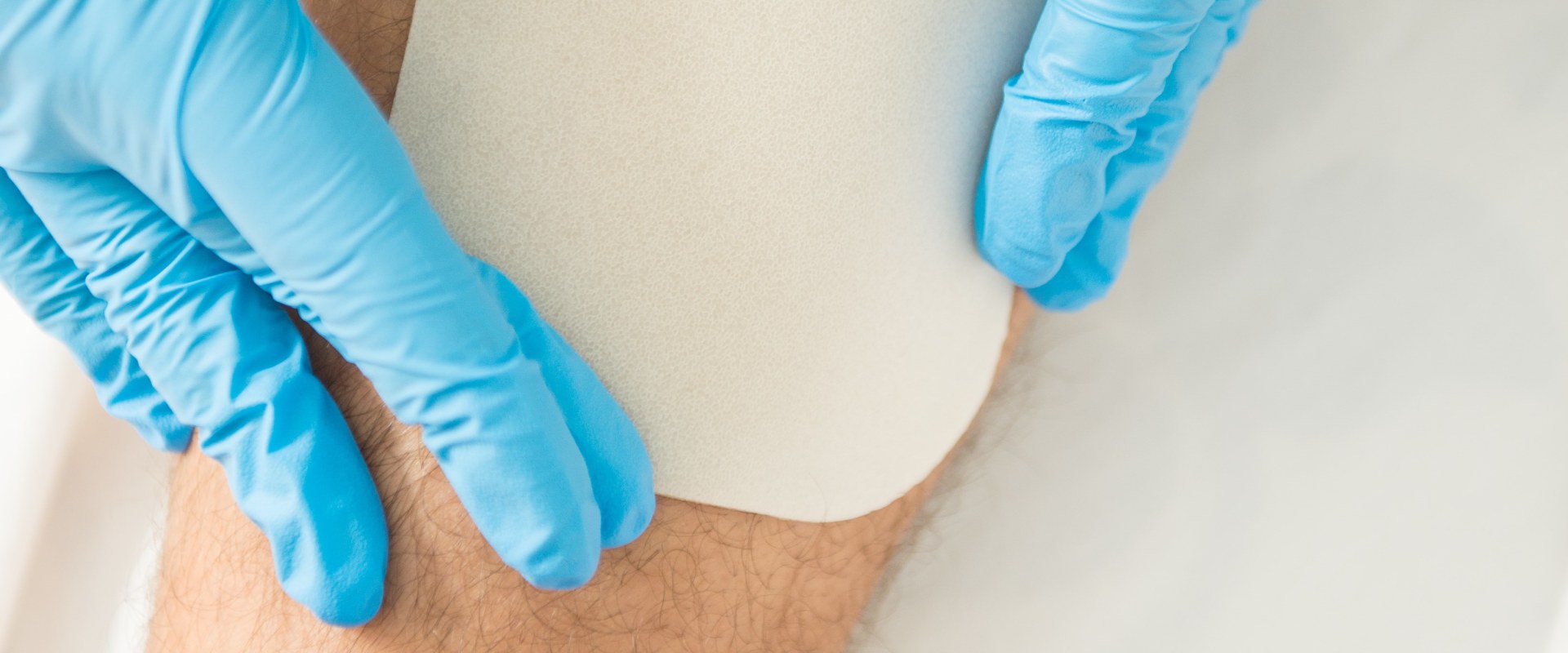 The Ultimate Guide to Wound Dressing: Expert Tips and Techniques