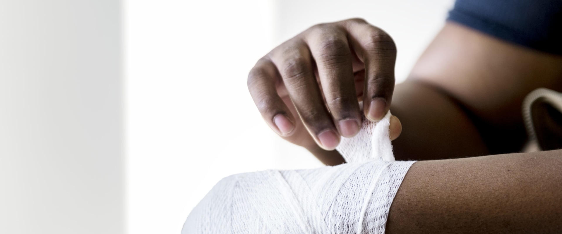 How to Treat a Skin Avulsion Wound and Promote Faster Healing in ...