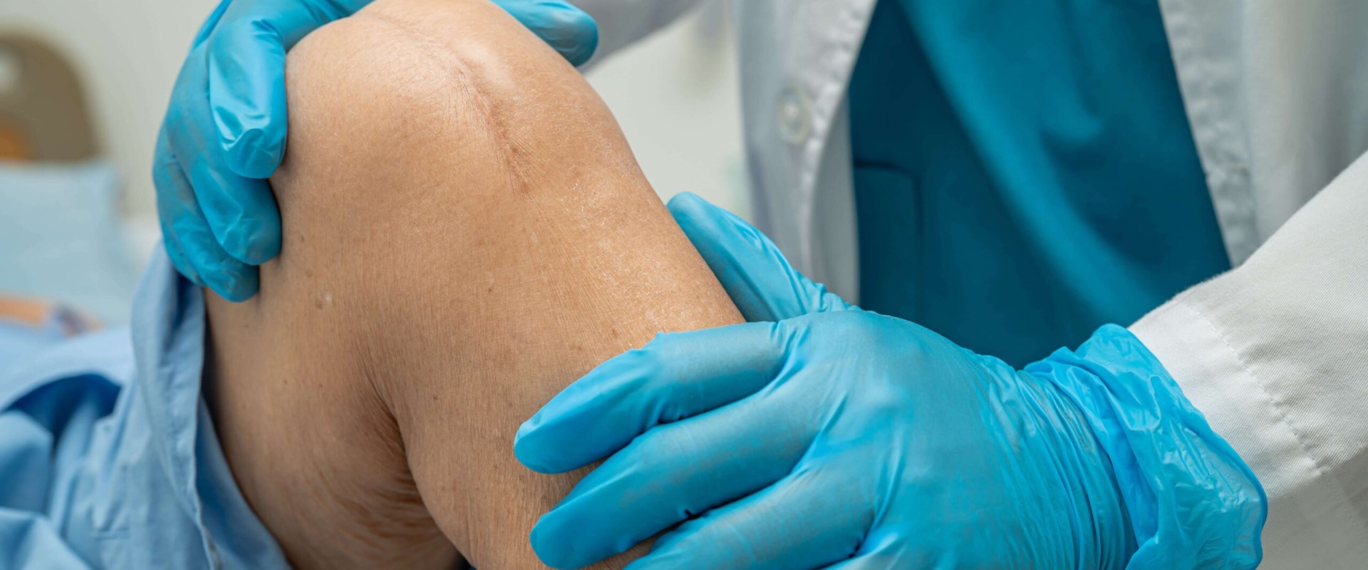 Scar Management Best Practices In Emergency Wound Treatment