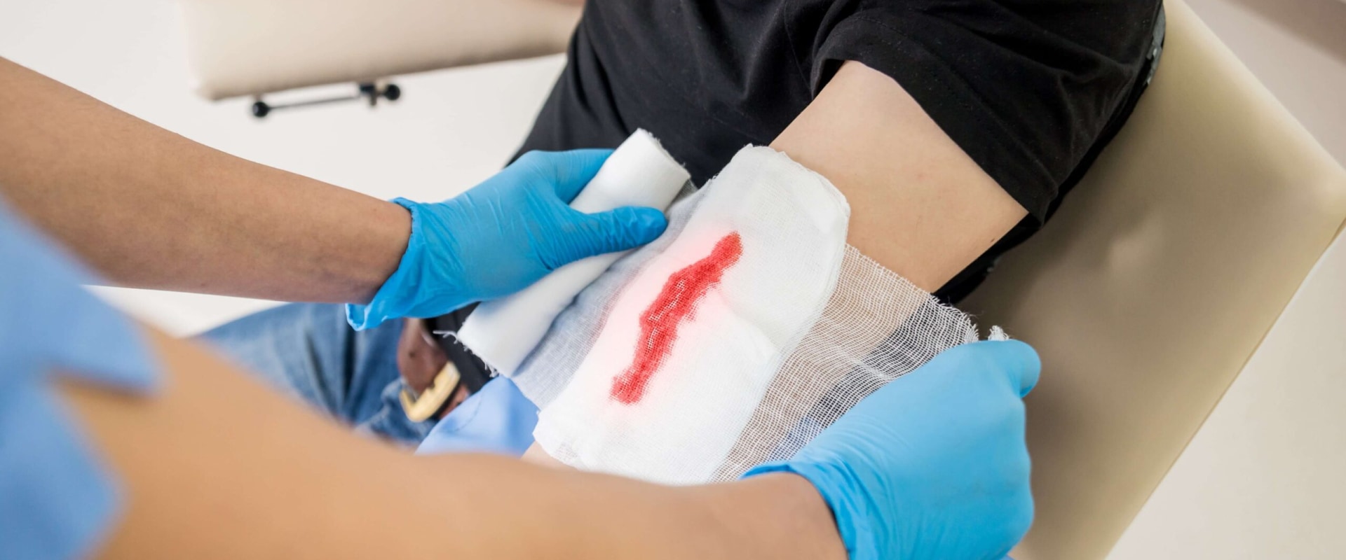 What Does a Healing Wound Smell Like? Spotting Safe Scents and ...